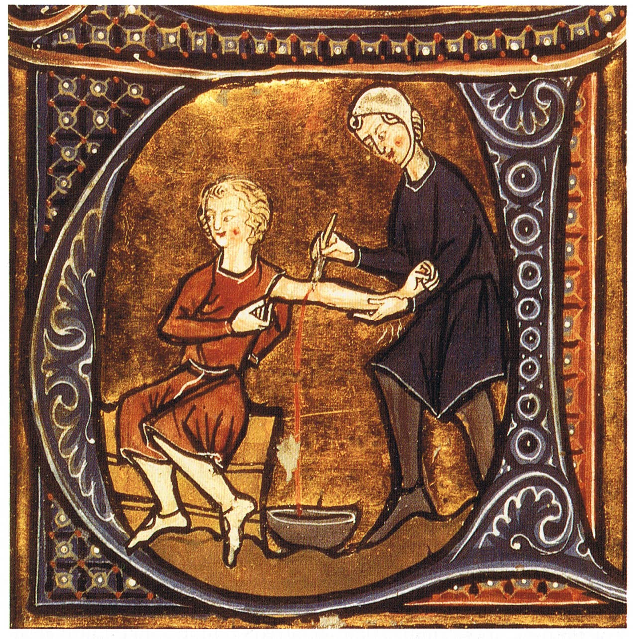 Medieval Remedies, Diseases and Cures: Dark Days of Medicine - Owlcation