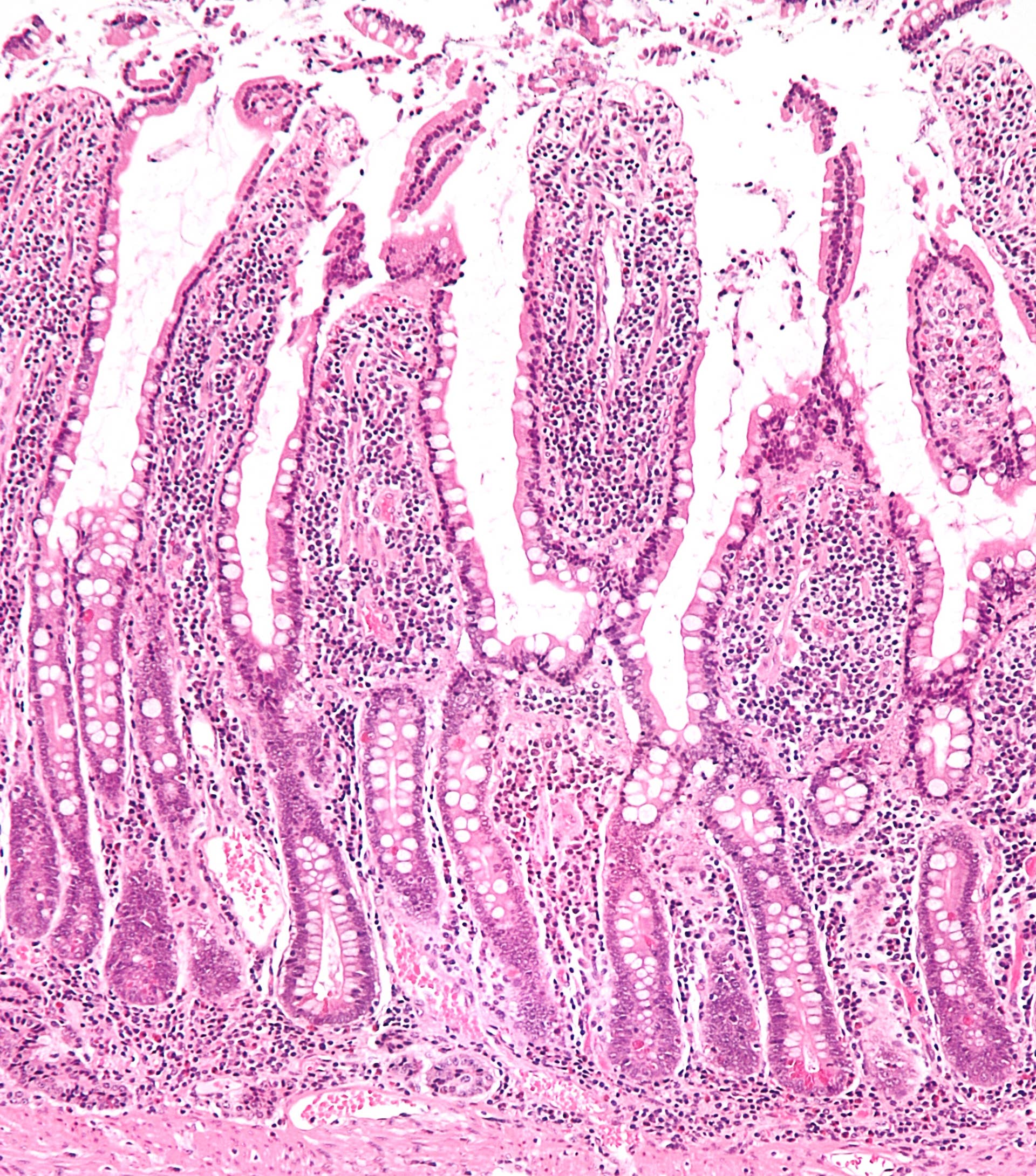 Paneth Cells and Their Association With Crohn's Disease - Owlcation