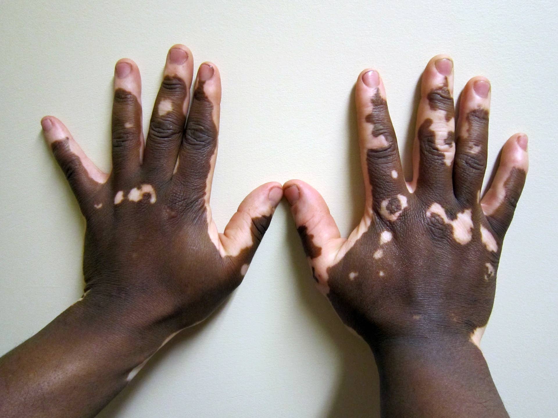 Pigments in the Human Body: Functions and Health Problems - Owlcation