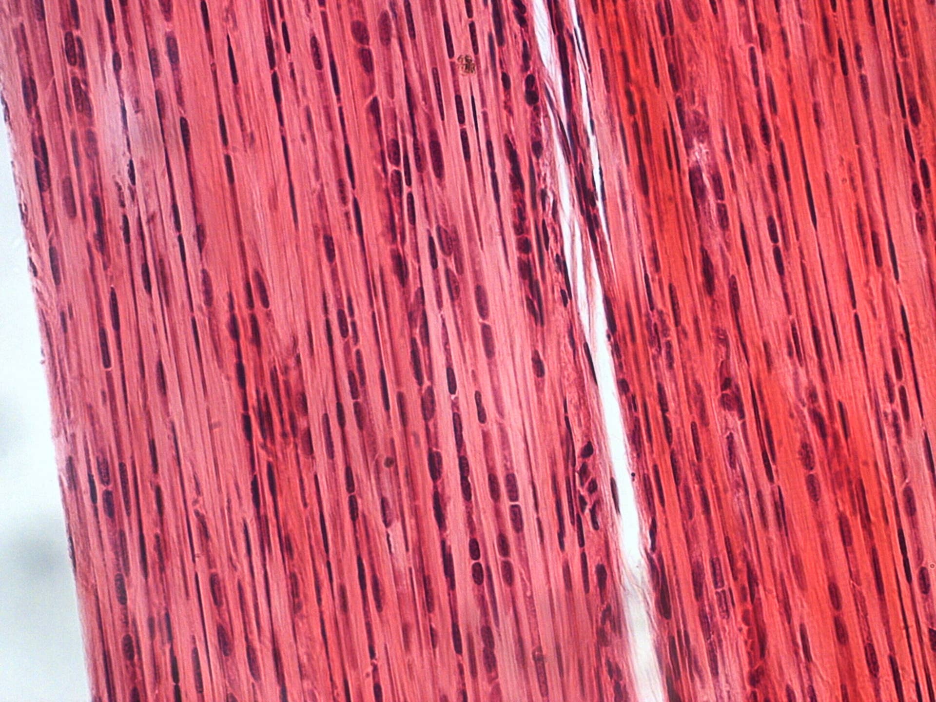 Interstitial Fluid and the Interstitium: Formation and Function - Owlcation