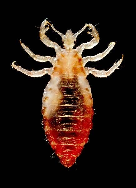 Trench Fever and Lice in World War I - Owlcation