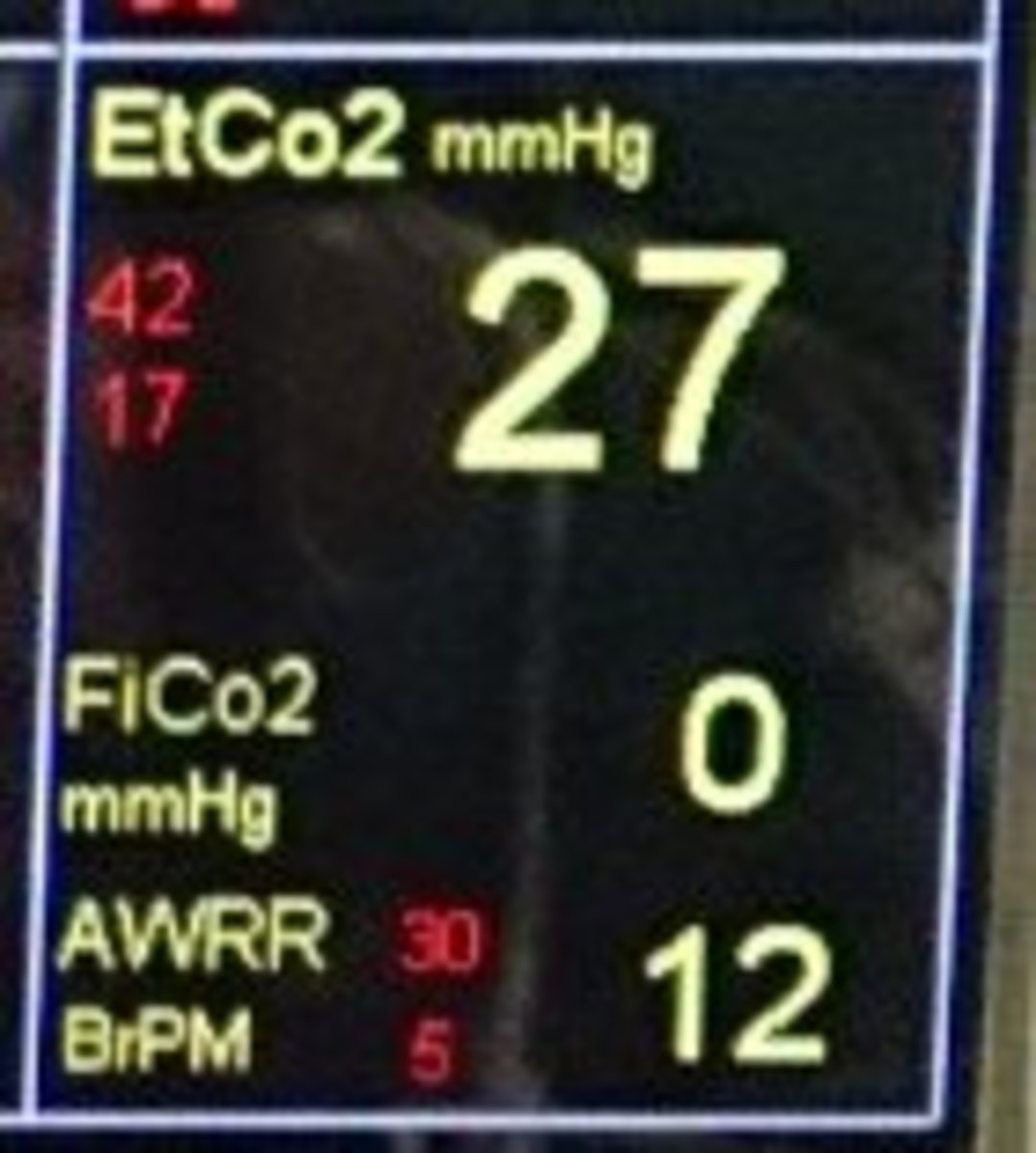 Capnography in Veterinary Anesthesia - Owlcation