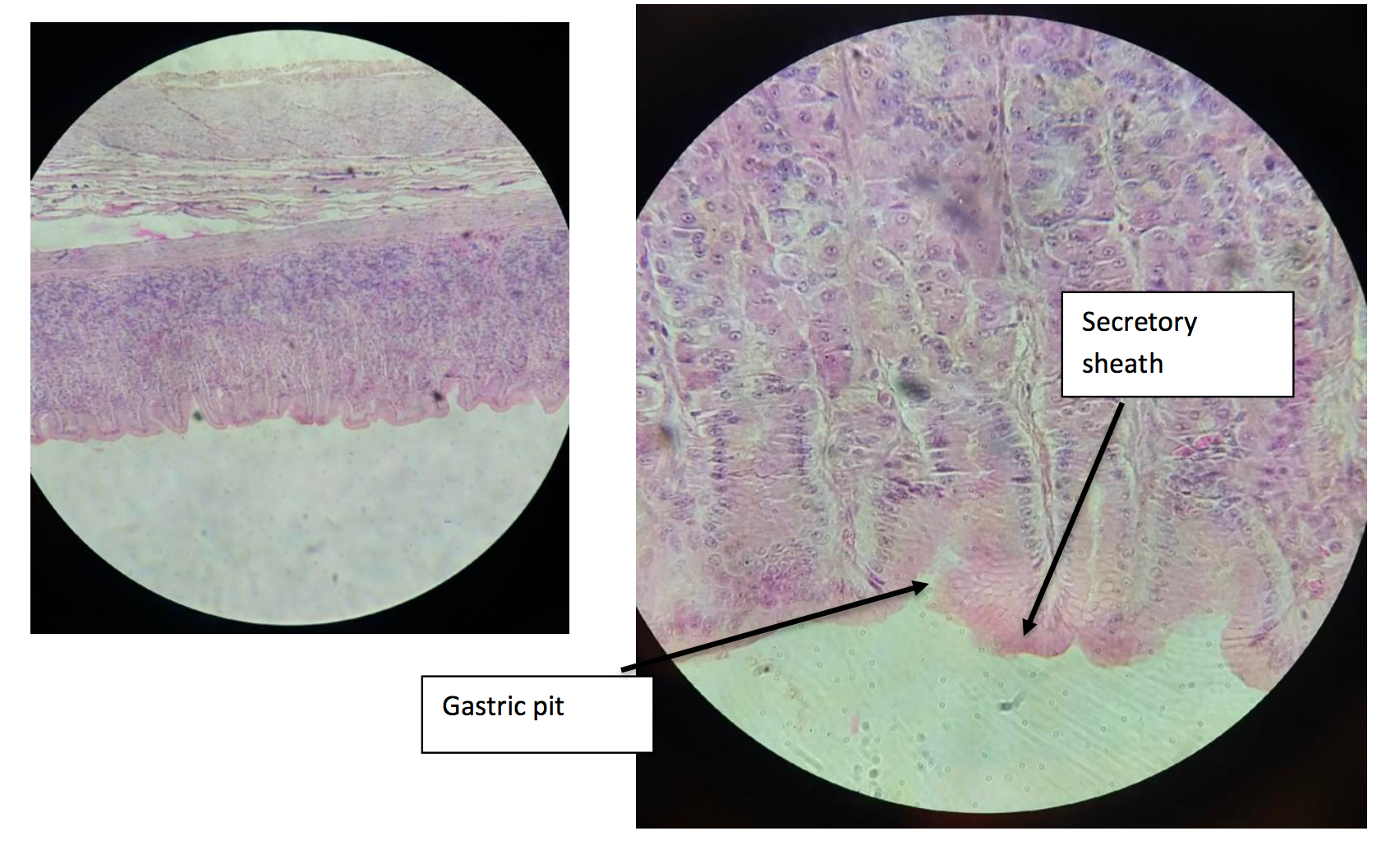 Stomach Histology Fundus Gastric Glands Wikipedia