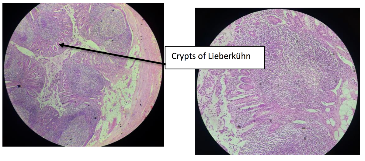 Histology and Anatomy of the Digestive System - Owlcation