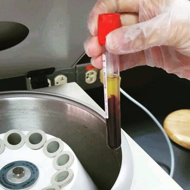 What Is the Difference Between Plasma and Serum? - Owlcation