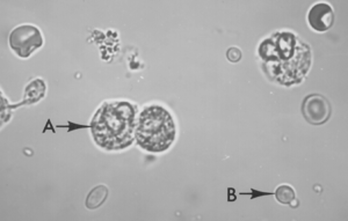 What Does a Hospital Medical Lab Technologist Do? - Owlcation