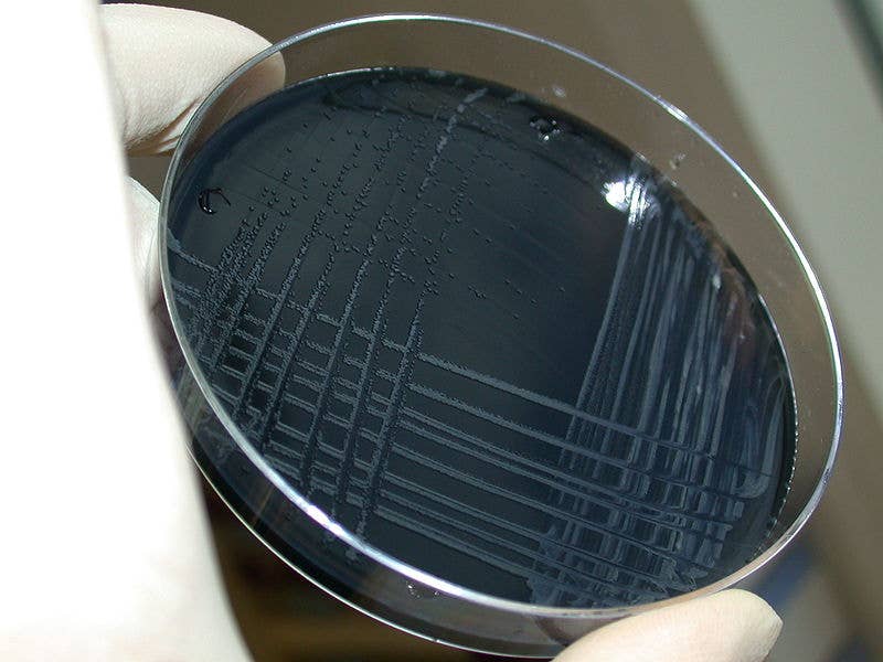 Types of Culture Media (Preservation to Fermentation) - Owlcation