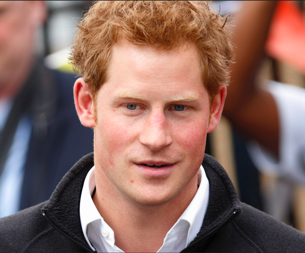 How Are Redheads Unique and Different? - Owlcation
