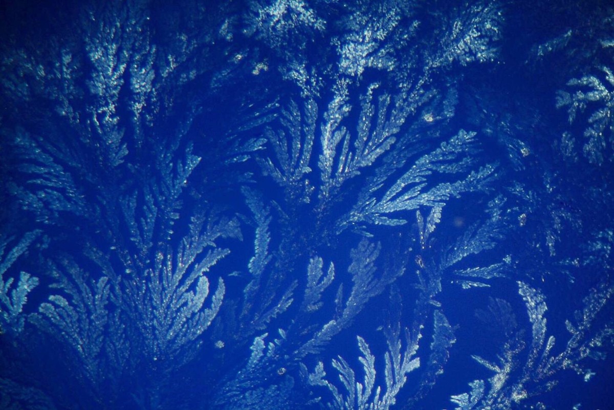 Saliva and Salivary Glands: Facts, Functions, and Disorders - Owlcation