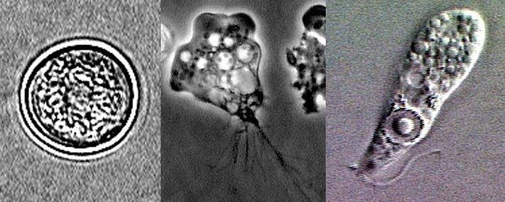 Amoebas in Pond Water, Dysentery, and Brain Inflammation - Owlcation