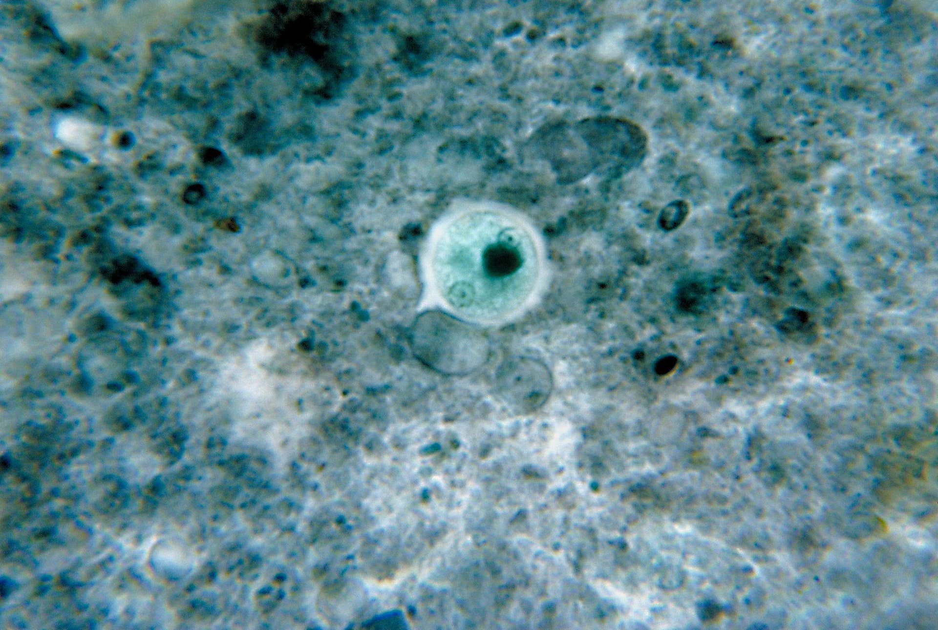 Amoebas in Pond Water, Dysentery, and Brain Inflammation - Owlcation