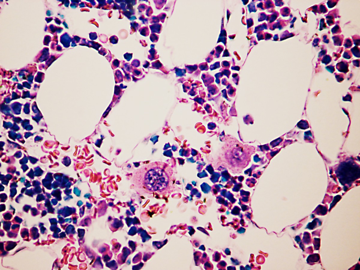 Bone Marrow Functions, Stem Cells, and Transplants - Owlcation