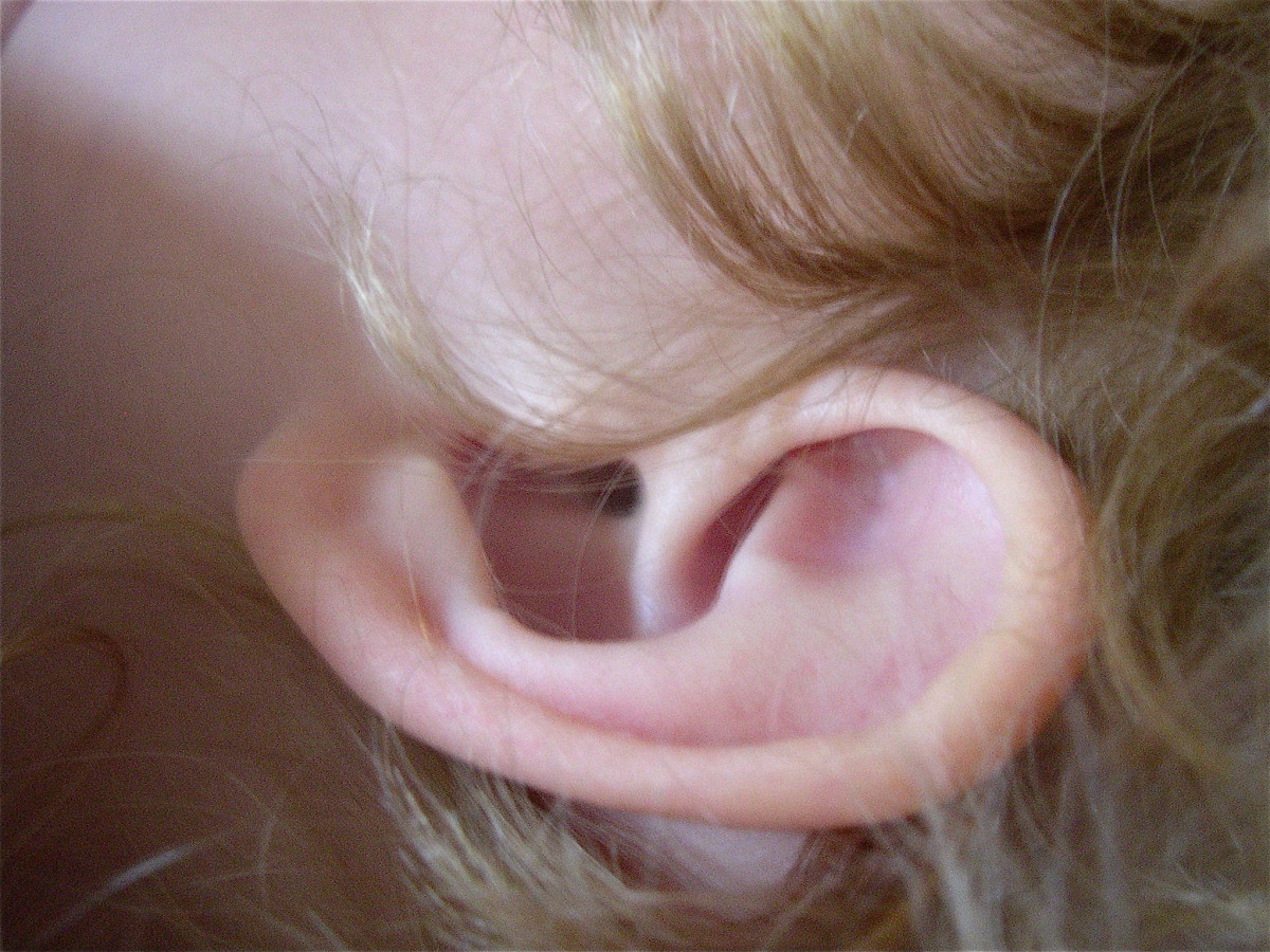 Earwax: Facts, Functions, and Potential Health Problems - Owlcation