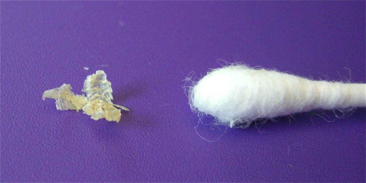 Earwax: Facts, Functions, and Potential Health Problems - Owlcation