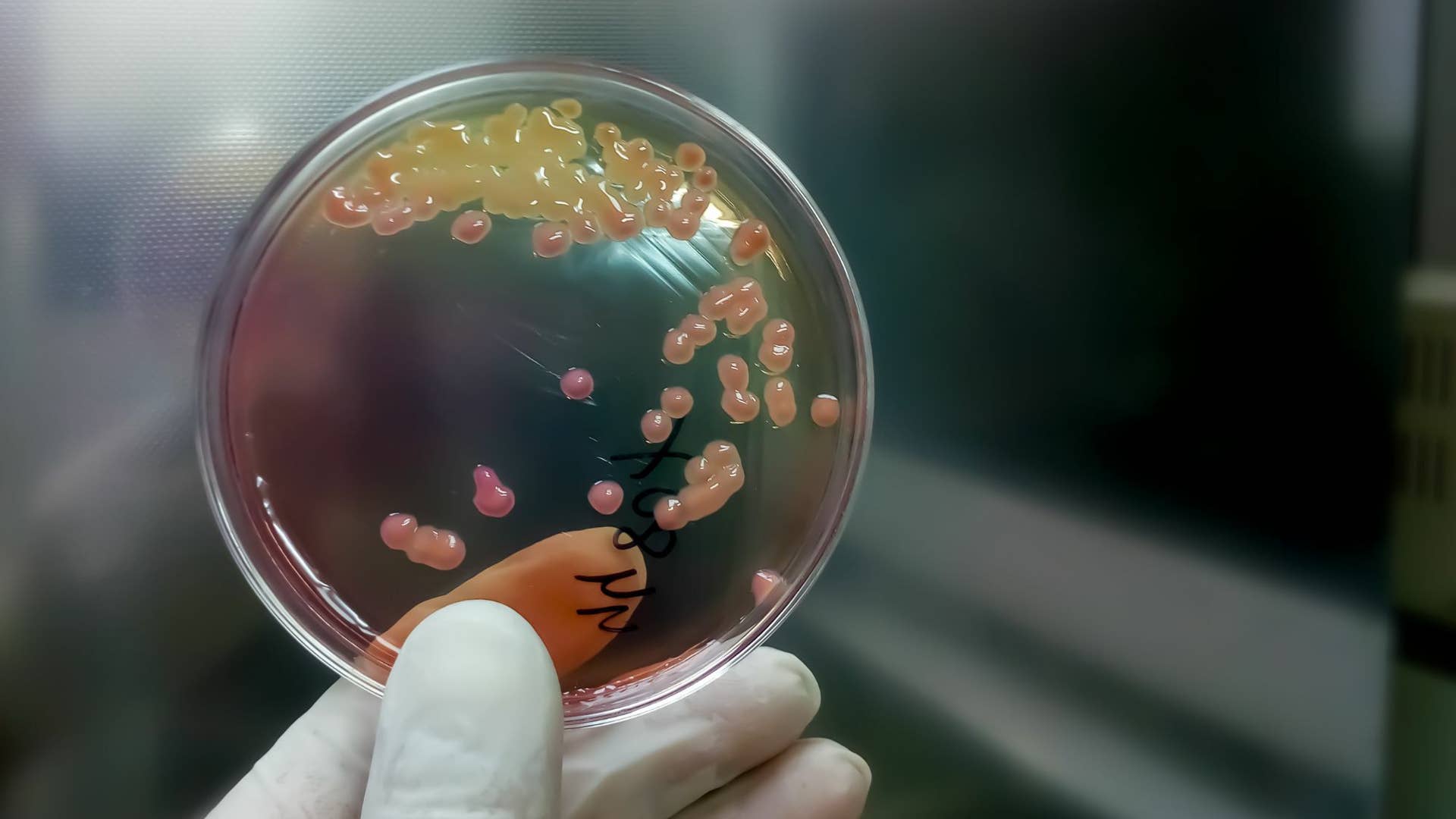 Types of Culture Media (Preservation to Fermentation) - Owlcation