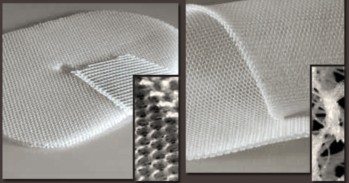 What Is Surgical Mesh? - Owlcation