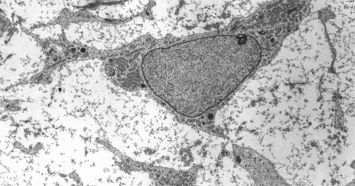 Adult and Induced Pluripotent Stem Cells: Facts and Uses - Owlcation