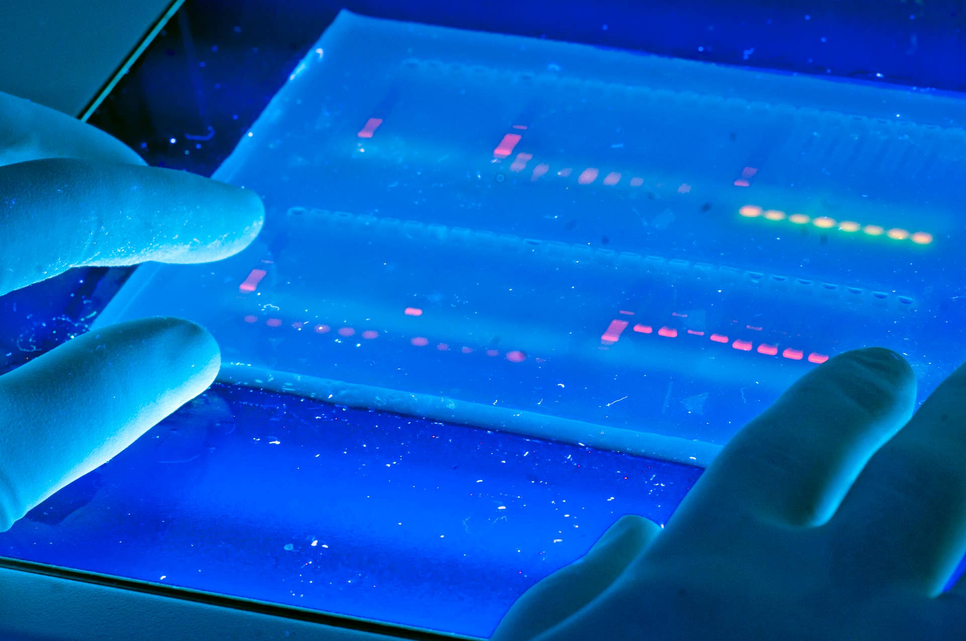 Does Having a Blood Transfusion Change Your DNA? - Owlcation
