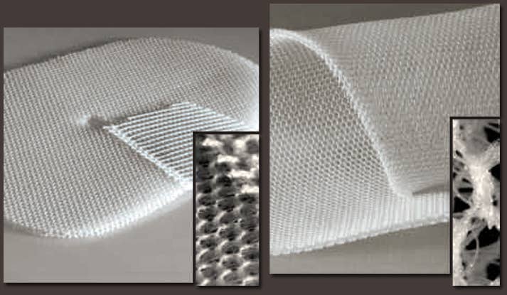 What Is Surgical Mesh? - Owlcation