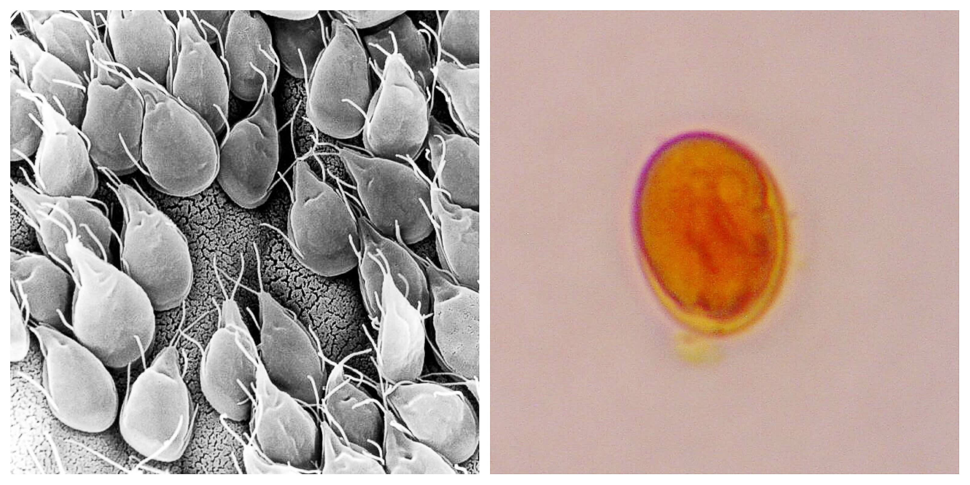 Giardia in the Intestine: Parasite Facts and Giardiasis Disease - Owlcation