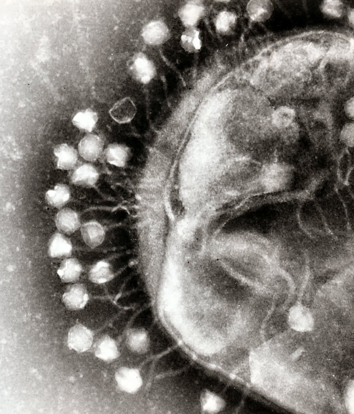 Antibiotic Resistance, Bacteriophages, and Phage Therapy - Owlcation
