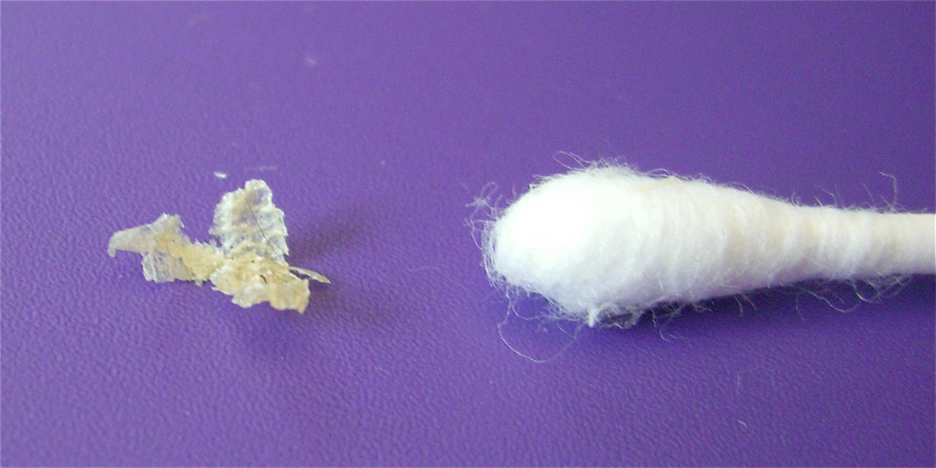 Earwax: Facts, Functions, and Potential Health Problems - Owlcation