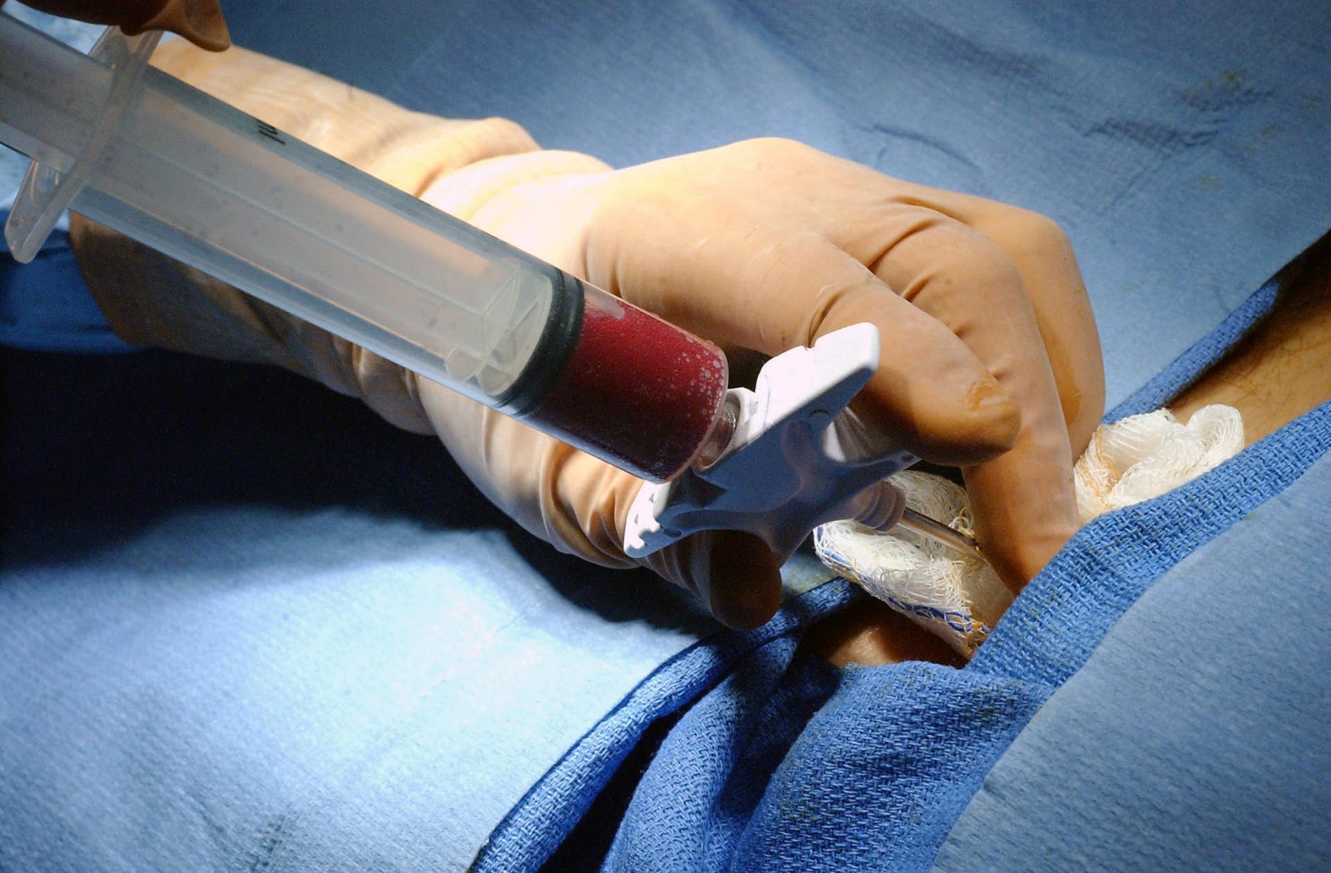 What Happens to a Biopsy After Surgery? - Owlcation