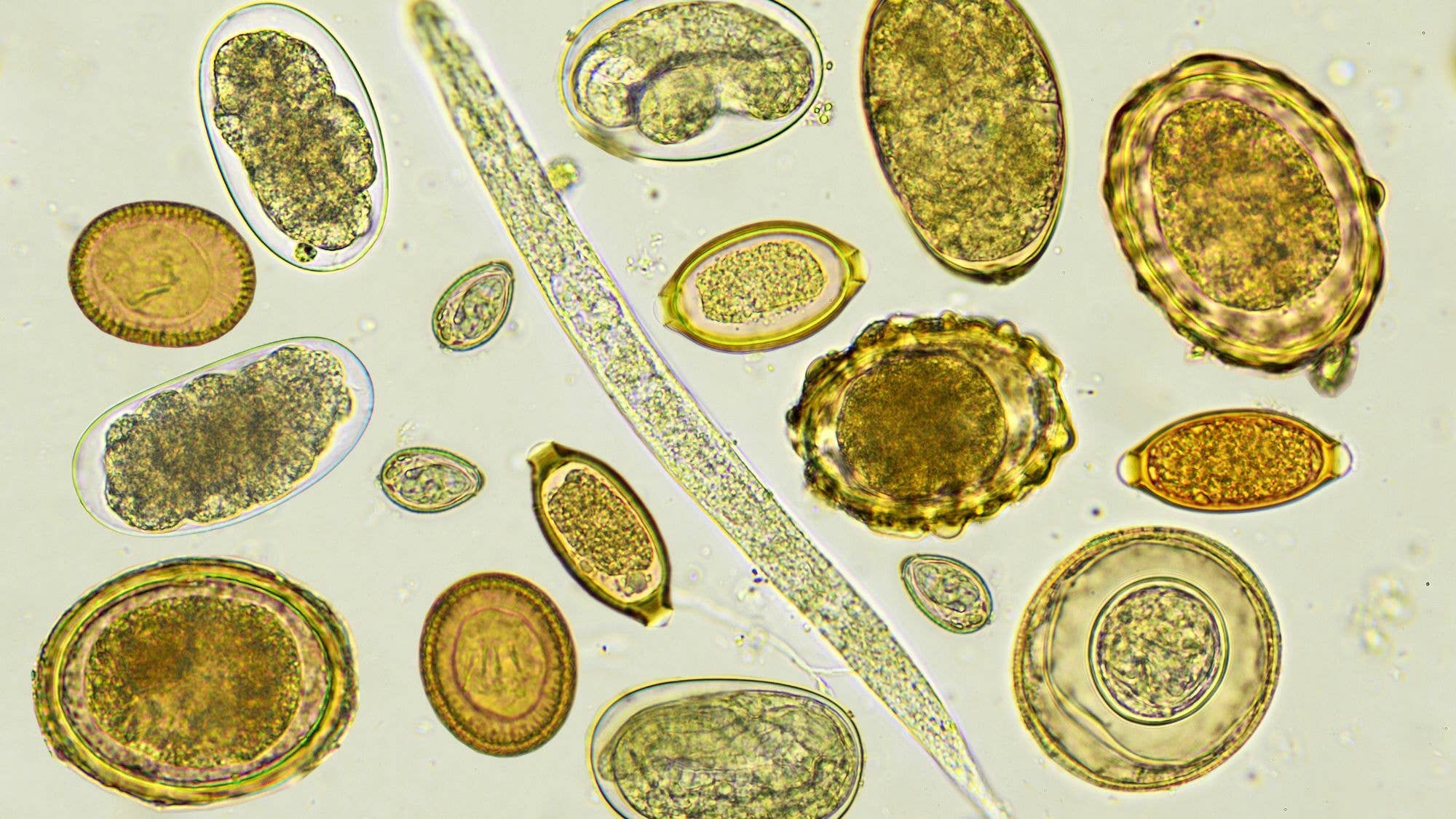 The Differences Between Viruses And Bacteria Owlcation